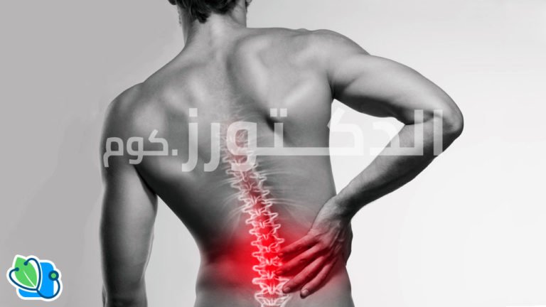 علاج ألم الظهر الشديد آلام الظهر و العمود الفقري الدكتورز كوم